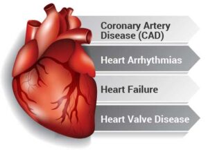 HEART DISEASE: SCOPE AND IMPACT - The Heart Foundation